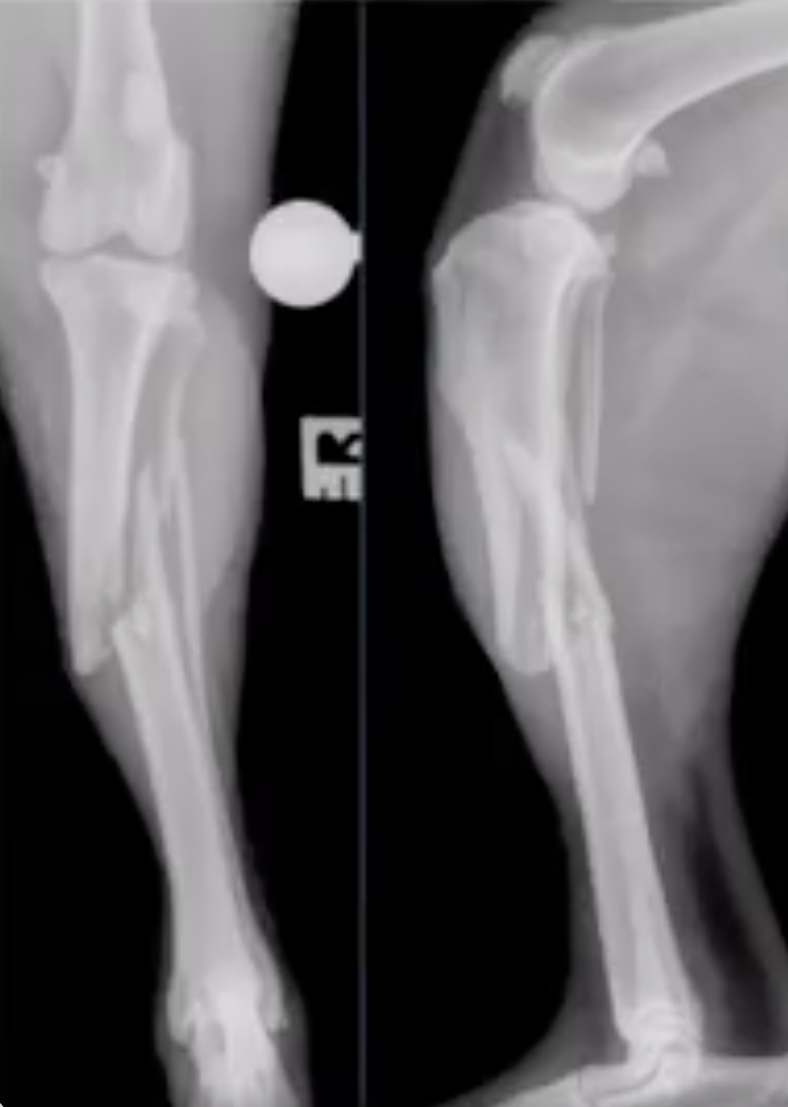 Basic Fracture Fixation - CPD Solutions’ Webinar Club